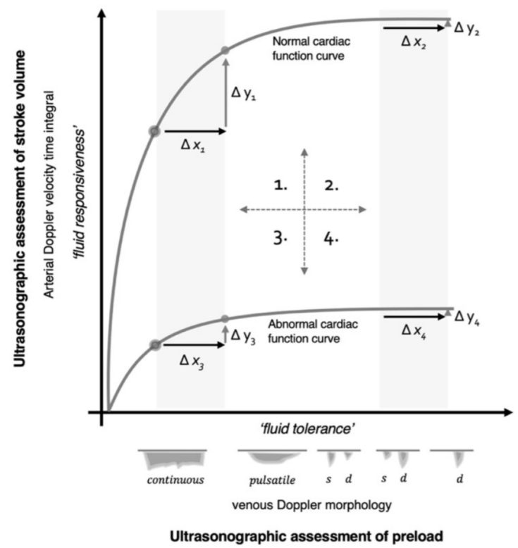 Changes in venous Doppler morphology with a wireless ultrasound patch ...